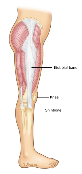 Iliotibial Band Syndrome: Your Guide to Pain-Free Movement! – Dr Loh's ...